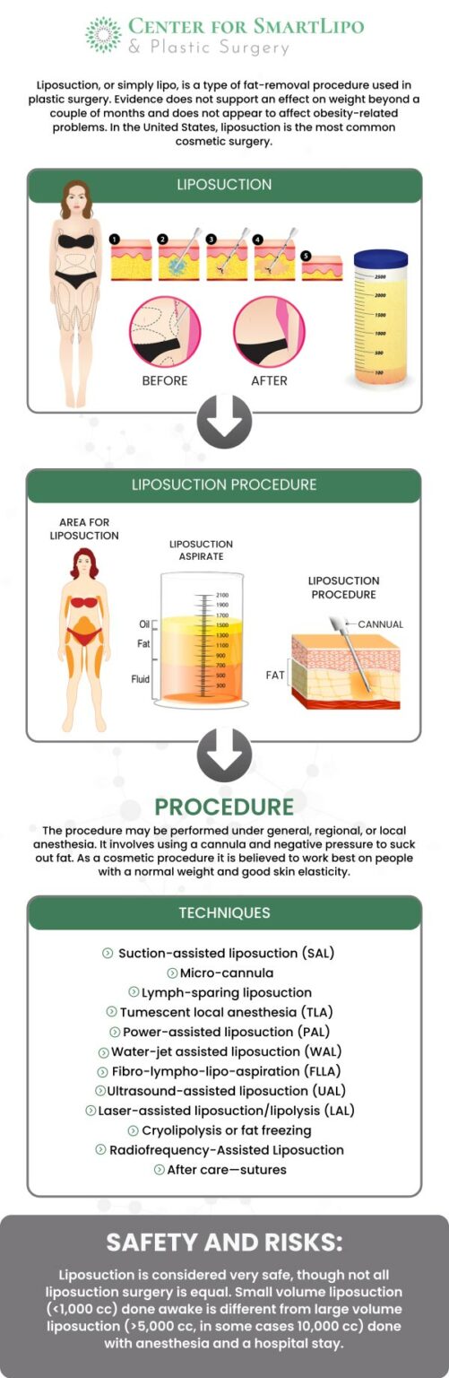 Liposuction Specialist Near Me in Philadelphia, PA