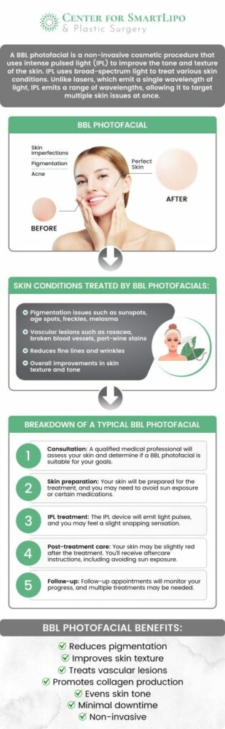 BBL Photofacial Cost in Philadelphia, PA | Dr. Durvi Patel